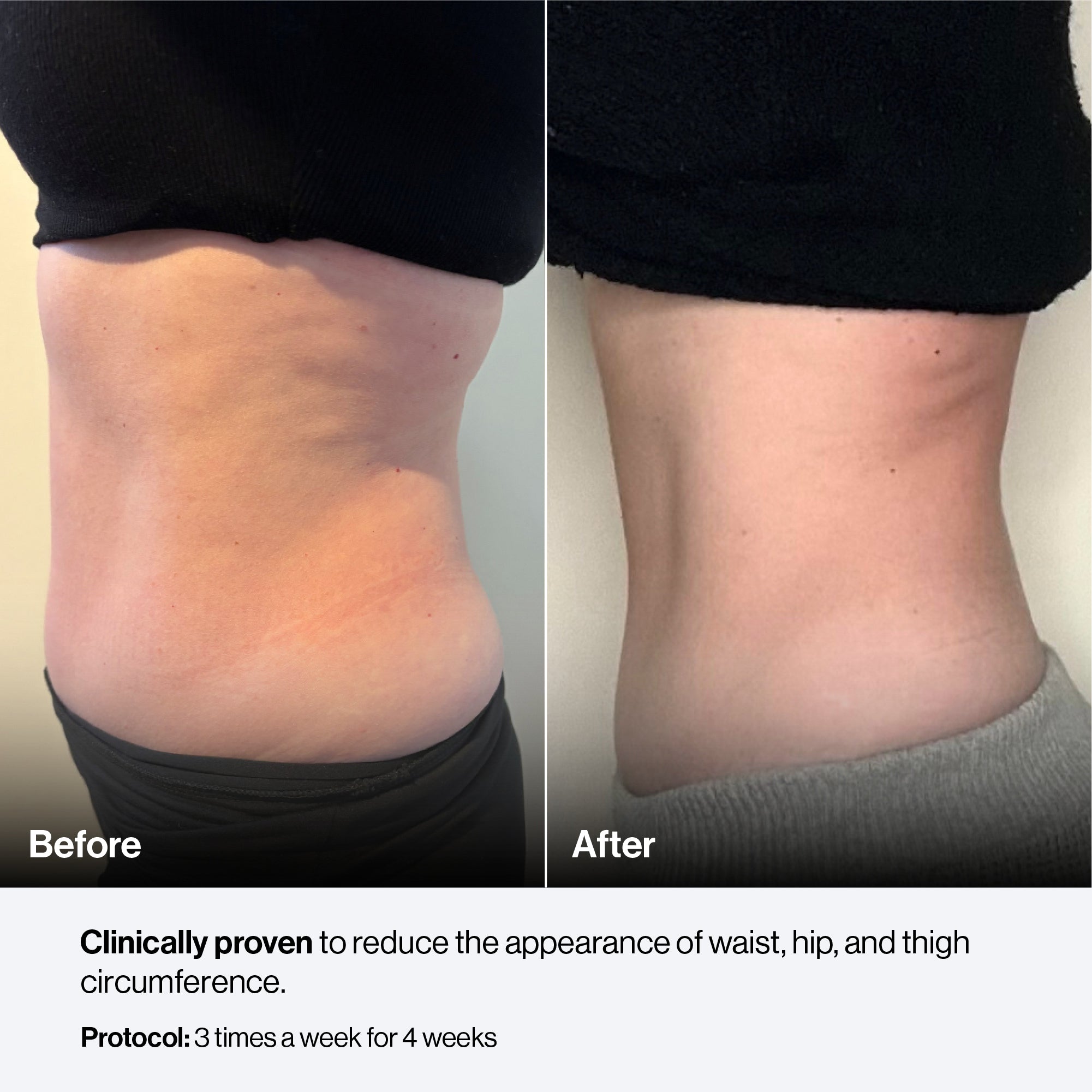 5-mode LED Red Light Therapy FDA-cleared Device | Celluma NOVA