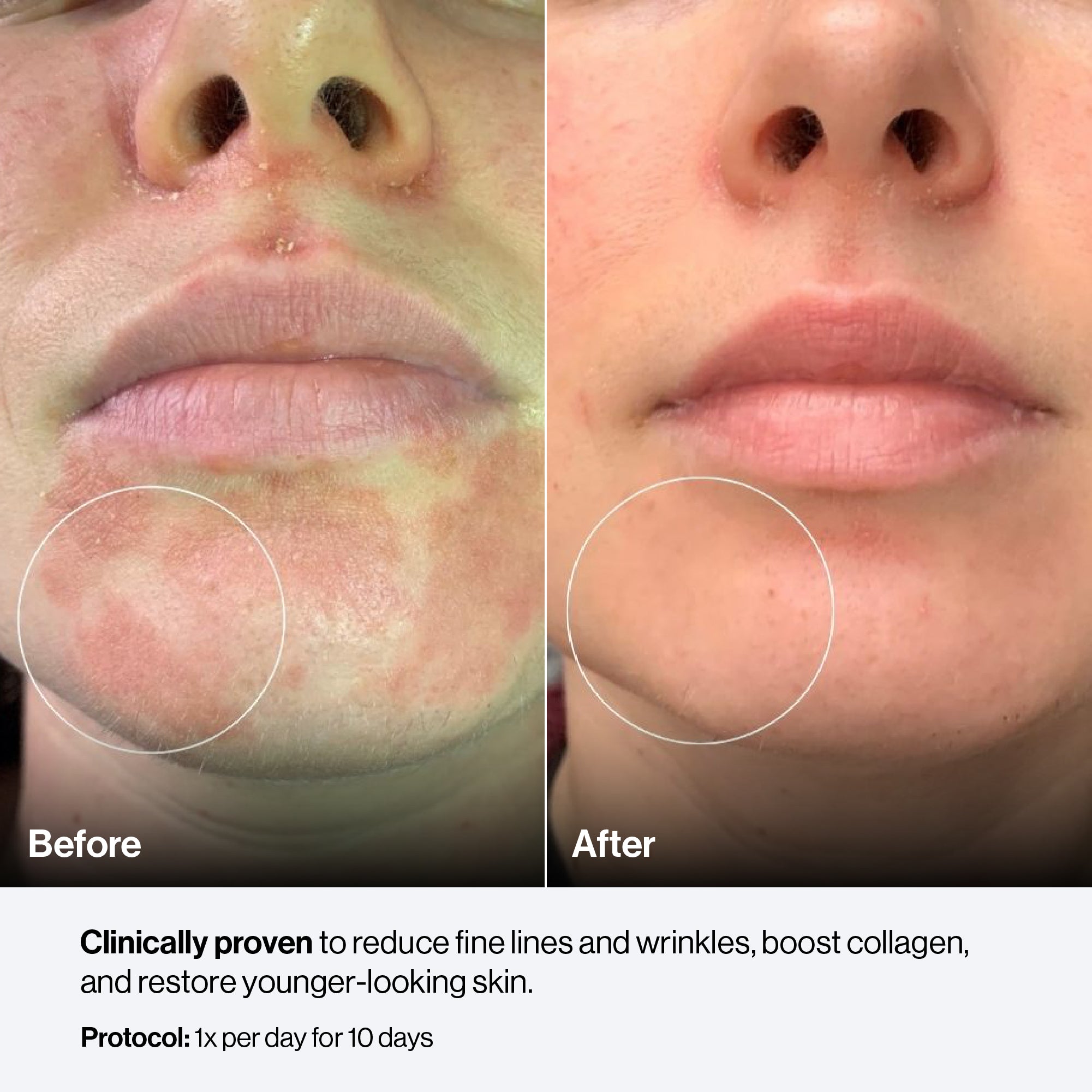 5-mode LED Red Light Therapy FDA-cleared Device | Celluma NOVA